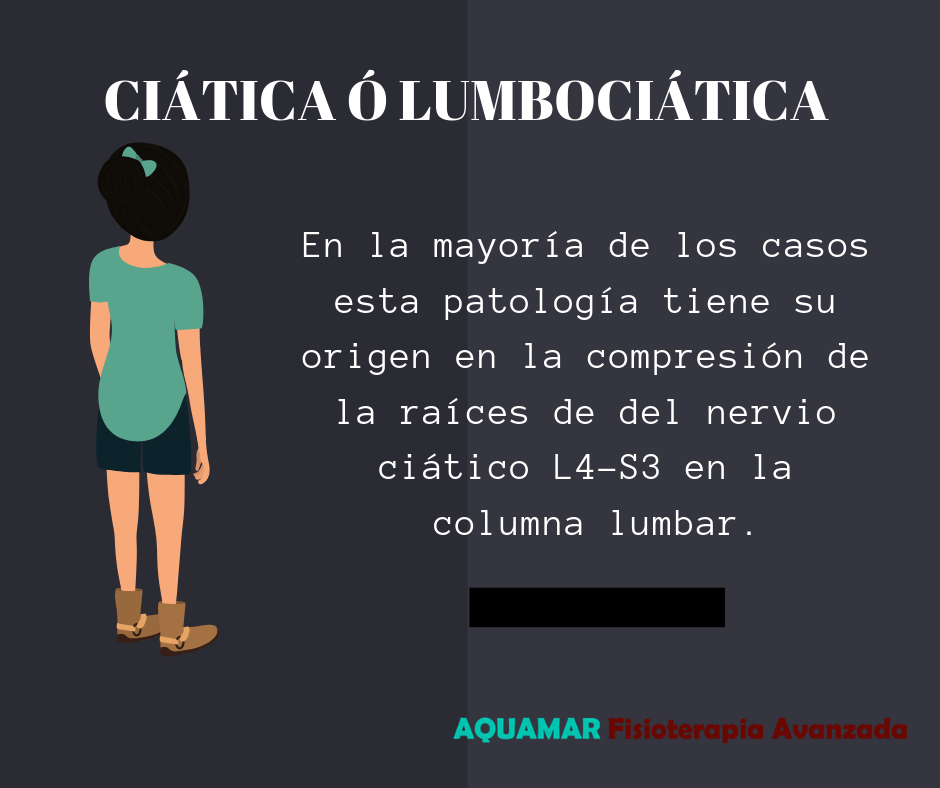 Ciática, lumbociatalgia, ciatalgia… ¿qué son? – Aquamar